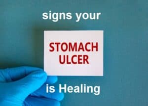 10 Clear Signs Your Ulcer Is Healing (Backed By Medical Insight) - Www ...